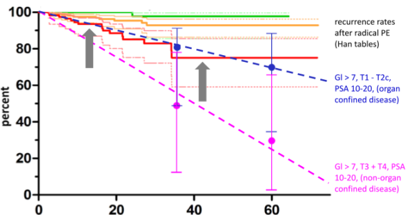 IRE - NanoKnife™ in prostate cancer