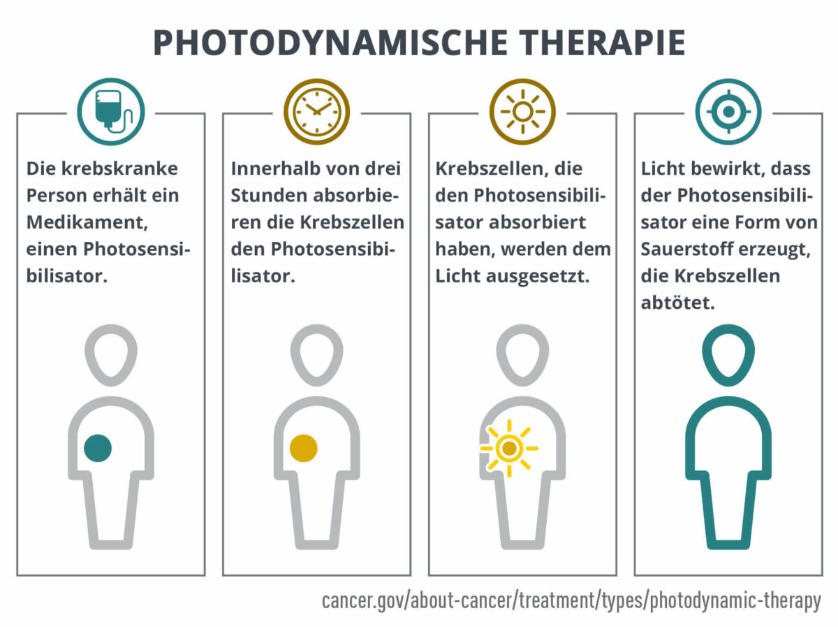 Photodynamic therapy for the treatment of prostate cancer